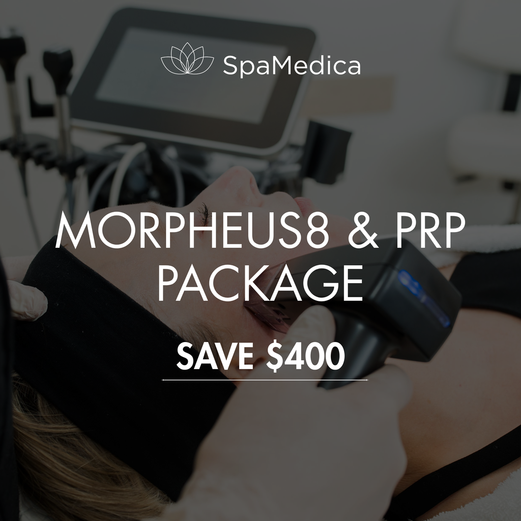 Morpheus8 & PRP (3 Treatments) – SpaMedica Toronto